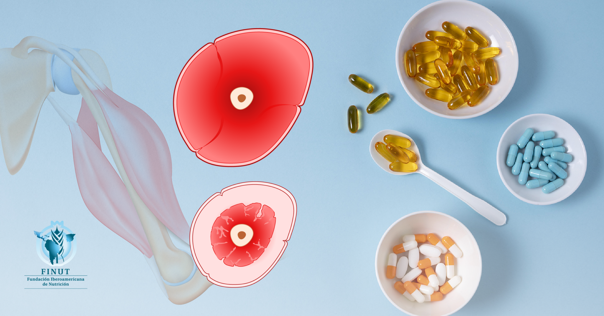 Avances en la suplementación nutricional para el tratamiento de la ...